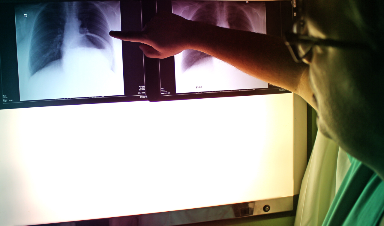 Sulfato de Bario | Médico - Medio de Contraste Baritado en México